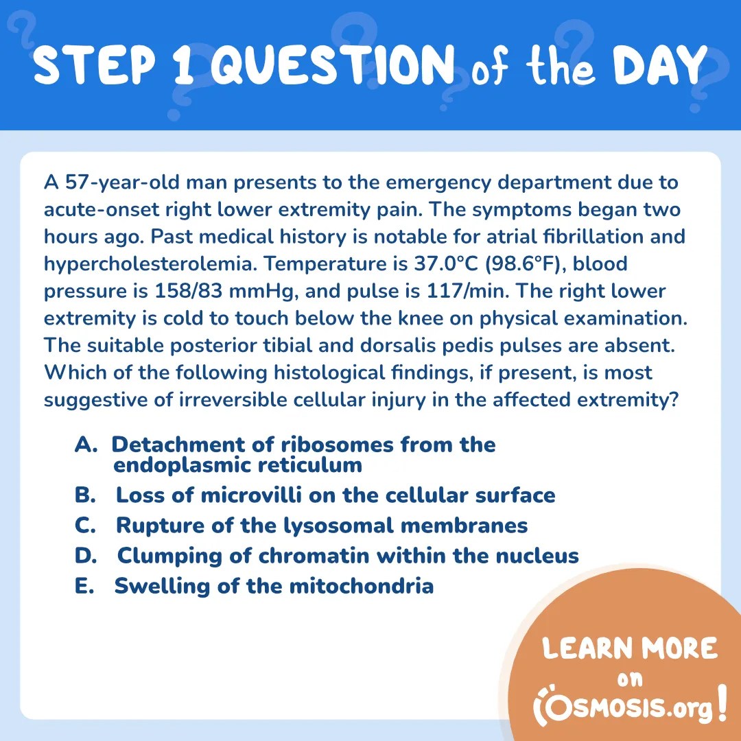 USMLE® Step 1 Question of the Day: Lower extremity pain - Osmosis Blog
